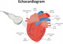 Echocardiography - Ballarat Cardiology